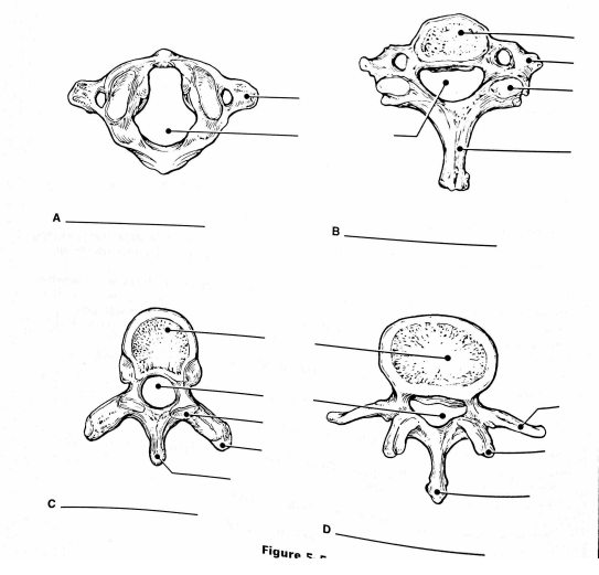 Figure 5-5, A-D shows superior views of four types of verteb | Quizlet